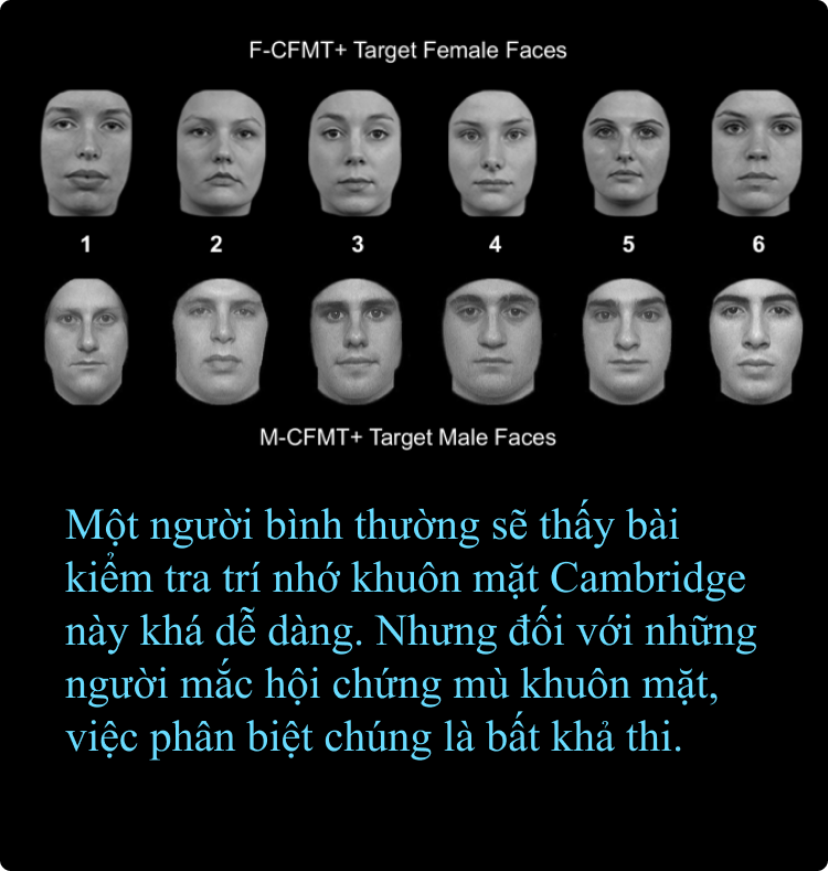 Thế giới trong mắt người "mù mặt": Khi bạn không phân biệt được bất cứ ...